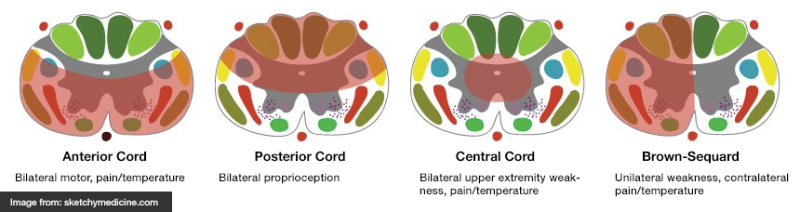 Differential Diagnosis of Weakness