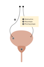 Differential Diagnosis of Acute Urinary Retention