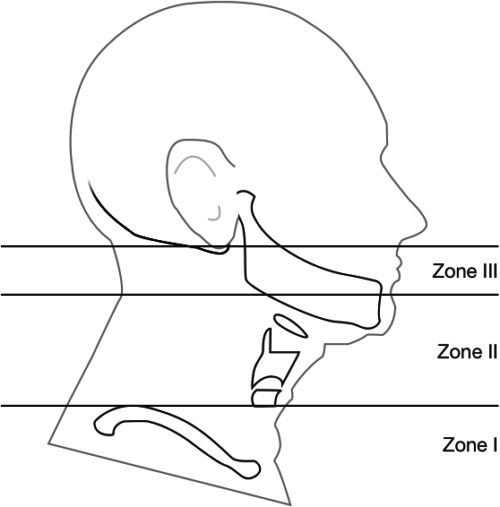 Differential Diagnosis of Penetrating Neck Trauma