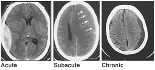 A Systematic Approach to the Interpretation of CT Head