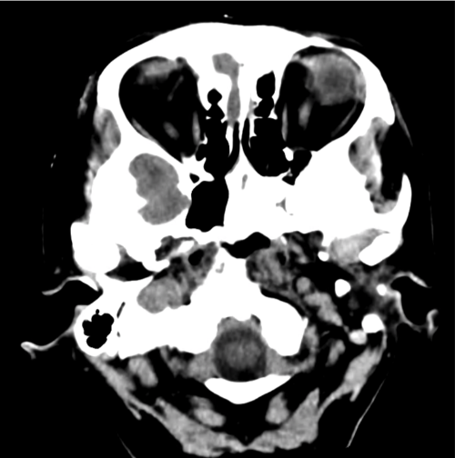 ct-mass_02 - Differential Diagnosis of