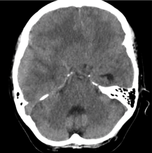 ct-mass_07 - Differential Diagnosis of