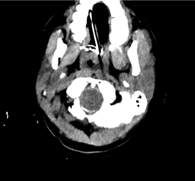 ct-trauma_01 - Differential Diagnosis of