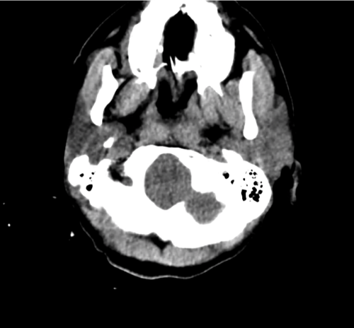ct-trauma_02 - Differential Diagnosis of