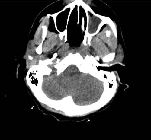 ct-trauma_04 - Differential Diagnosis of