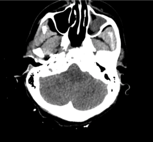 ct-trauma_05 - Differential Diagnosis of