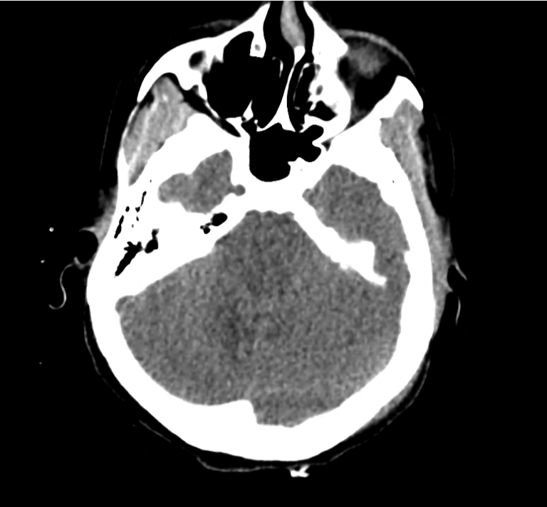 ct-trauma_08 - Differential Diagnosis of