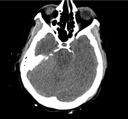 ct-trauma_09 - Differential Diagnosis of
