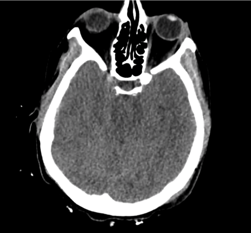 ct-trauma_10 - Differential Diagnosis of