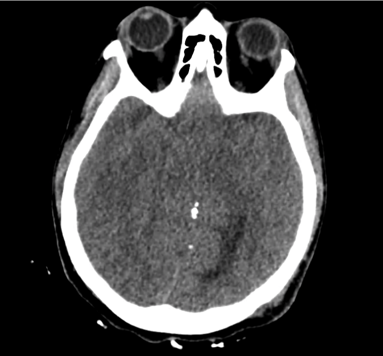 ct-trauma_12 - Differential Diagnosis of