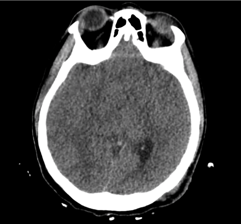 ct-trauma_13 - Differential Diagnosis of