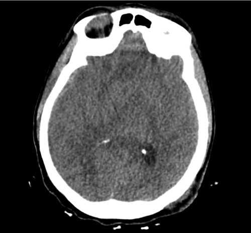 ct-trauma_14 - Differential Diagnosis of