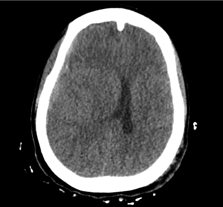 ct-trauma_17 - Differential Diagnosis of