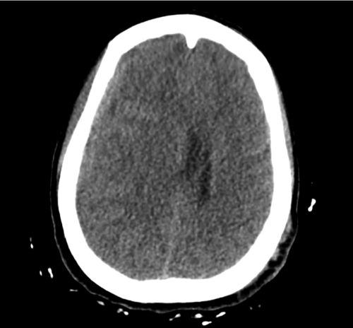 ct-trauma_18 - Differential Diagnosis of