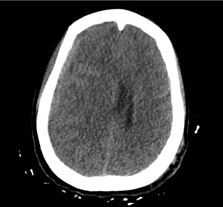ct-trauma_18 - Differential Diagnosis of