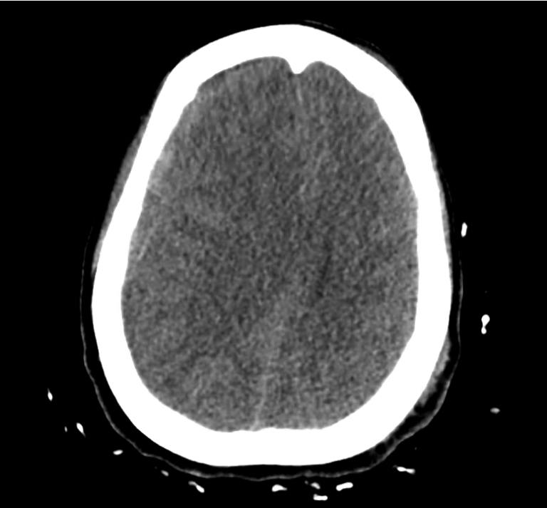 ct-trauma_19 - Differential Diagnosis of