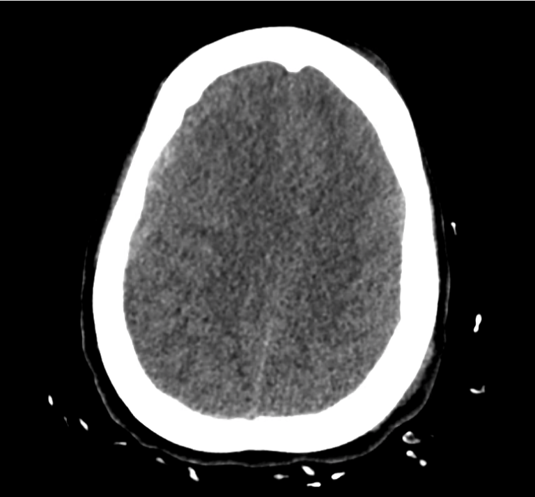 ct-trauma_20 - Differential Diagnosis of