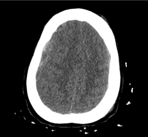 ct-trauma_21 - Differential Diagnosis of