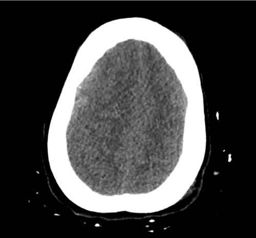 ct-trauma_22 - Differential Diagnosis of