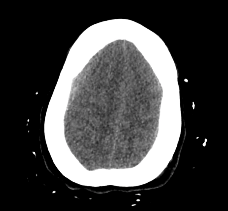 ct-trauma_23 - Differential Diagnosis of