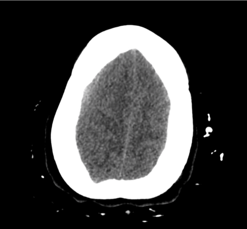 ct-trauma_24 - Differential Diagnosis of
