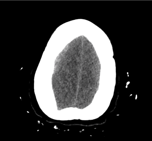 ct-trauma_25 - Differential Diagnosis of