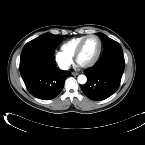 ct_annotation_01 - Differential Diagnosis of