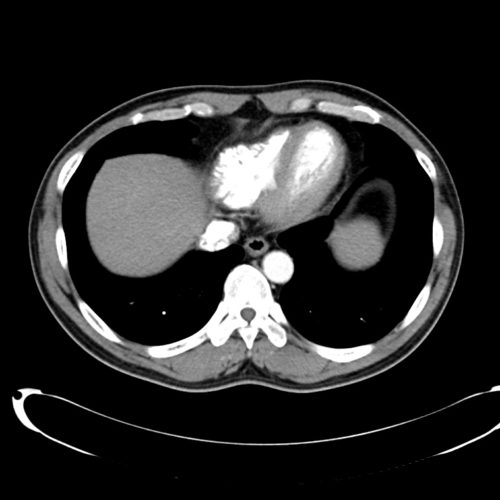 ct_annotation_02 - Differential Diagnosis of