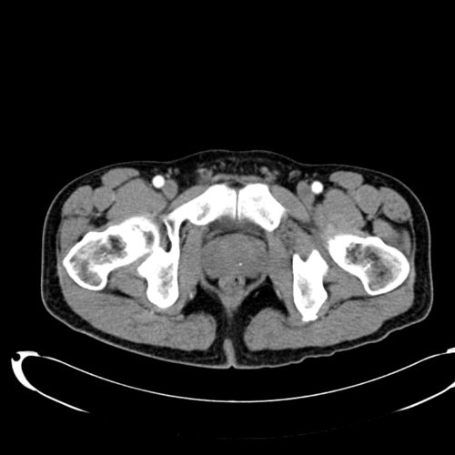 ct_annotation_21 - Differential Diagnosis of