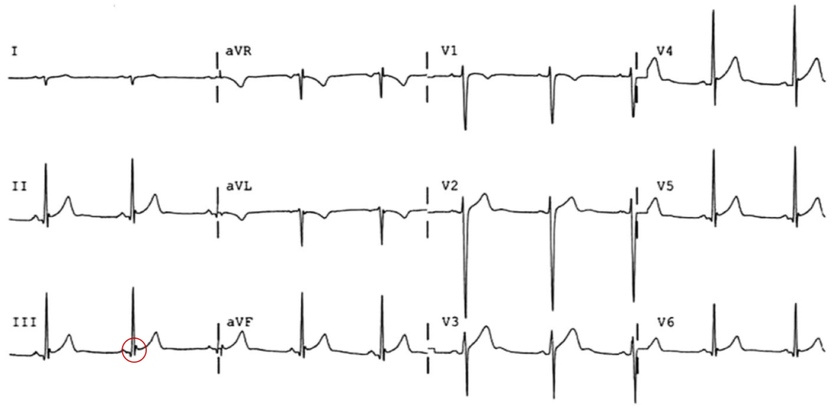 Pediatrics Category - Differential Diagnosis of