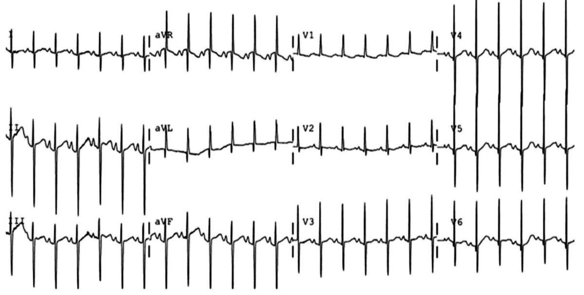 Differential Diagnosis of ECG Guide: Pediatrics