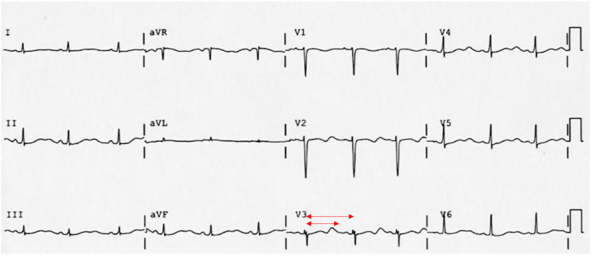 Pediatrics Category - Differential Diagnosis of