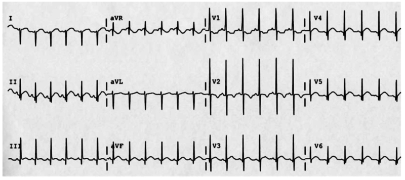 Differential Diagnosis of ECG Guide: Pediatrics