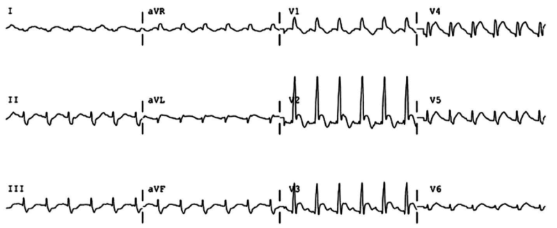 Differential Diagnosis of ECG Guide: Pediatrics