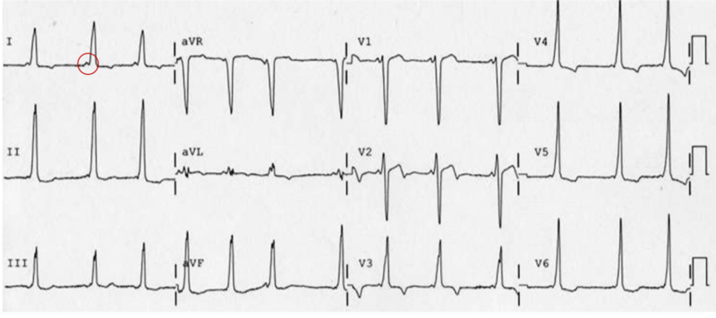 Differential Diagnosis of ECG Guide: Pediatrics