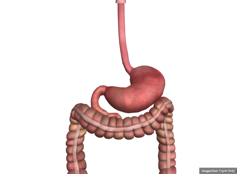 Large Bowel - Differential Diagnosis of