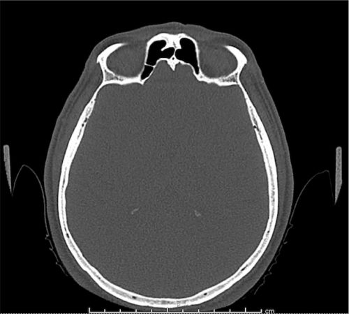 iofb_01 - Differential Diagnosis of
