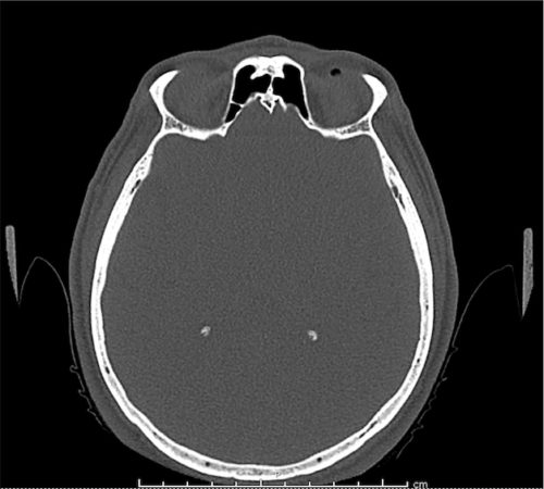 iofb_02 - Differential Diagnosis of