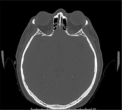iofb_06 - Differential Diagnosis of