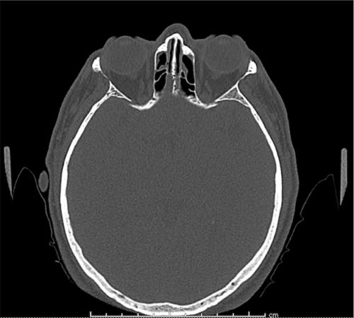 iofb_07 - Differential Diagnosis of