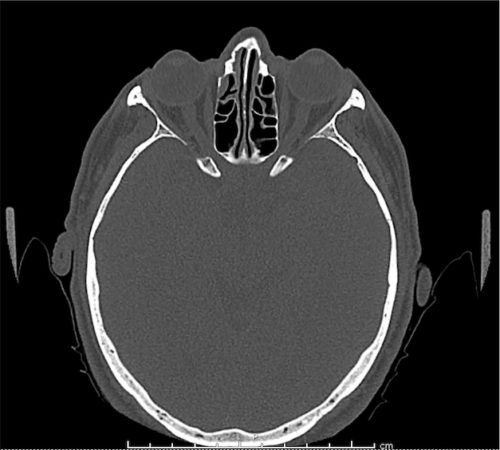 iofb_09 - Differential Diagnosis of