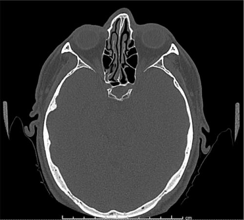 iofb_12 - Differential Diagnosis of
