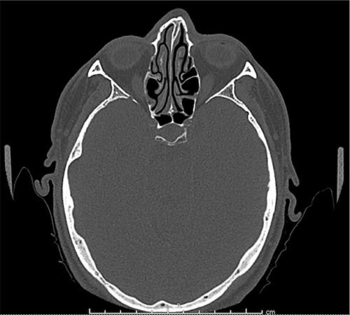 iofb_13 - Differential Diagnosis of