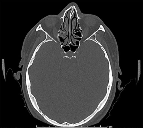 iofb_14 - Differential Diagnosis of