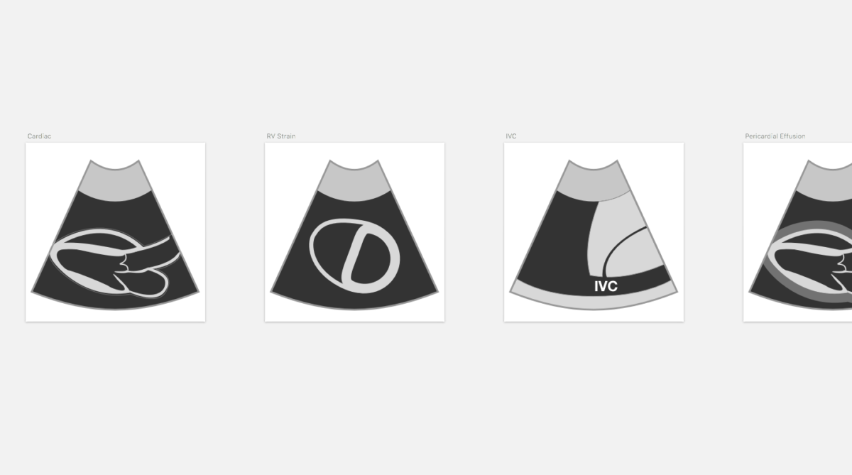 cardiac - Differential Diagnosis of
