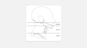 neck_zones - Differential Diagnosis of