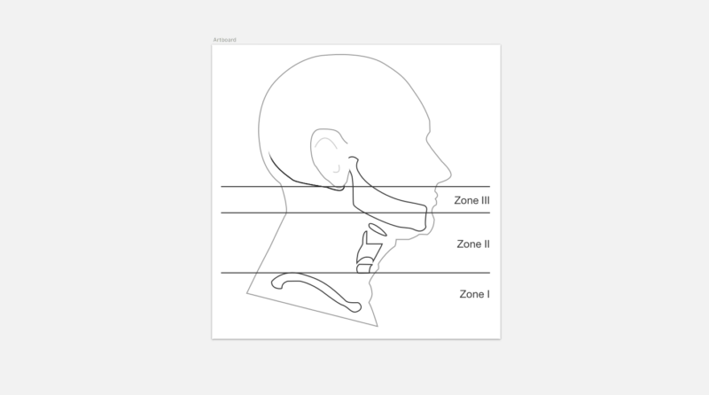 neck_zones - Differential Diagnosis of