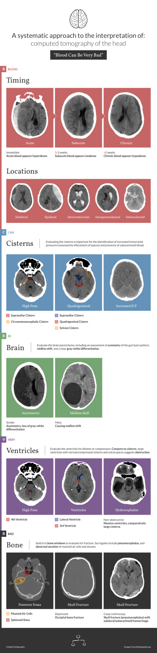 Differential Diagnosis of Infographic: CT Head Interpretation