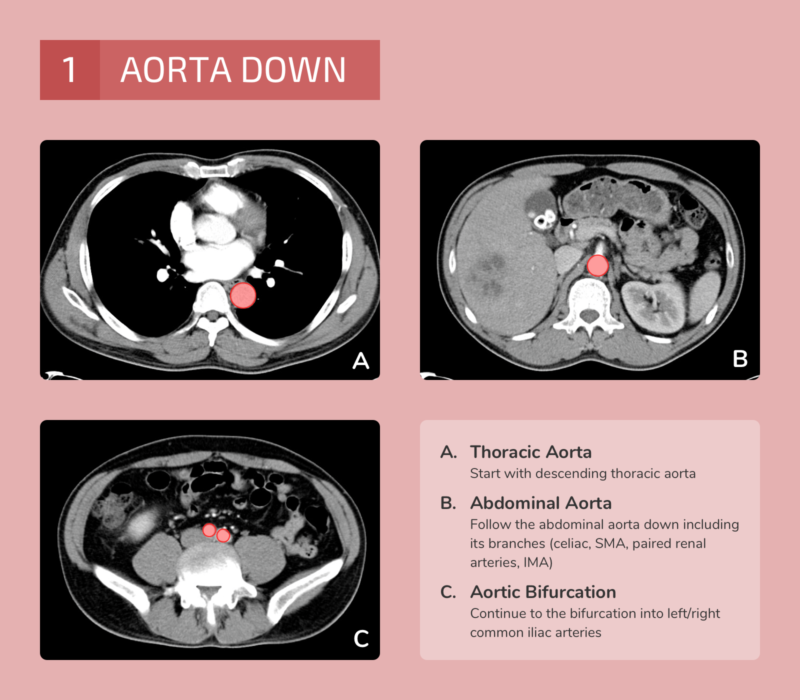 Differential Diagnosis of Infographic: CT Abdomen/Pelvis Interpretation