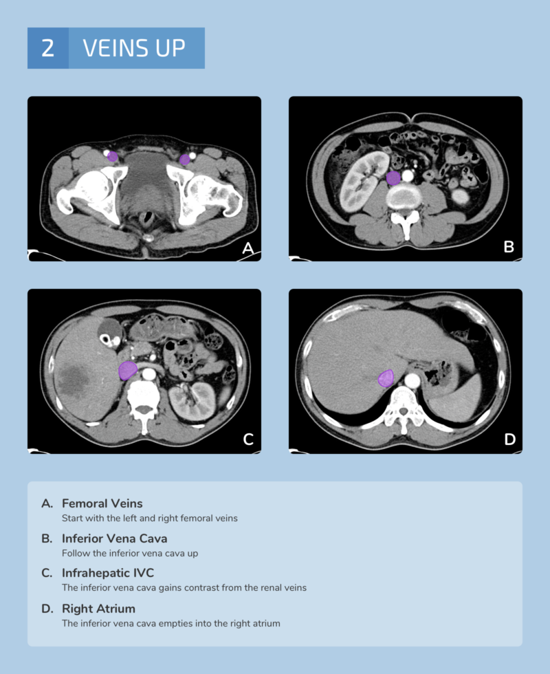 Differential Diagnosis of Infographic: CT Abdomen/Pelvis Interpretation